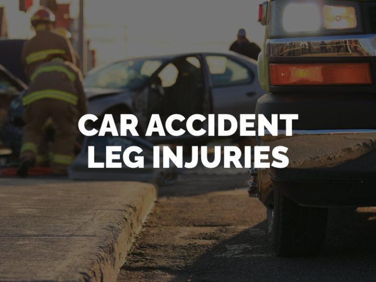 Car Accident Leg Injuries