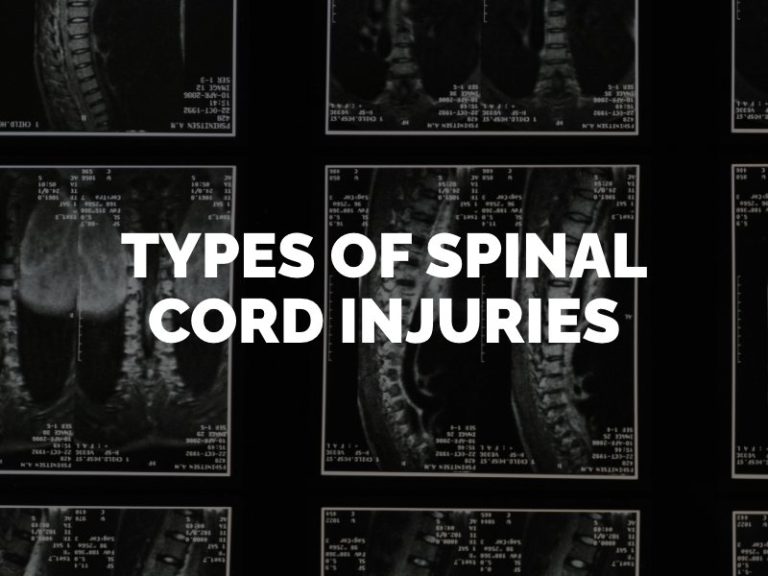 What Are the Types and Levels of Spinal Cord Injury?